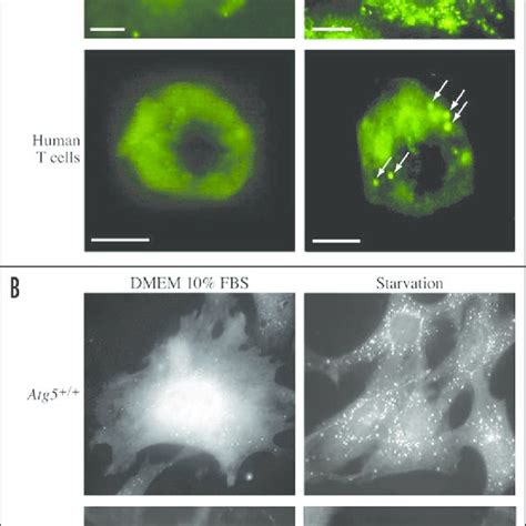 Gfp Lgg 1 Is An Autophagy Marker In C Elegans Gfp Lgg 1 Expression Download Scientific