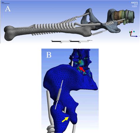 Finite Element Analysis In An Ischiofemoral Impingement Model Derived