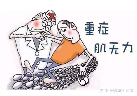 运动神经元病的症状有哪些治疗运动神经元病的偏方又是什么 知乎