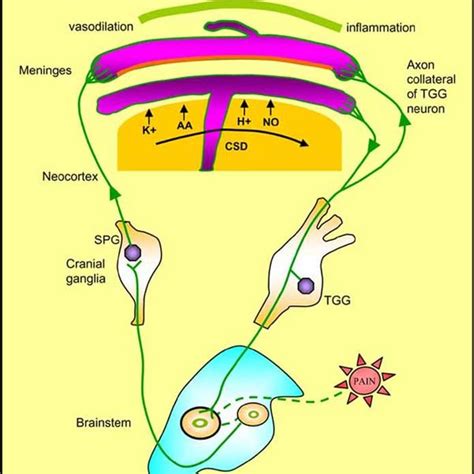 Phases During A Migraine Attack Prodromal Phase Aura Headache Phase