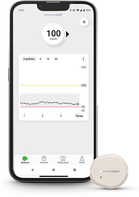 Dexcom One Dexcom