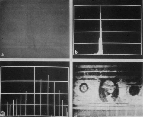 An Example Of Histogram Equalization A Original Image B Histogram