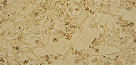 The Percent Viable Cells Versus Concentration Of Compound 2a After