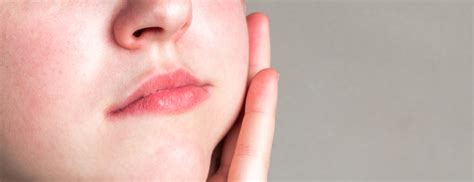 Facial Swelling Guide Facial Puffiness Holland And Barrett