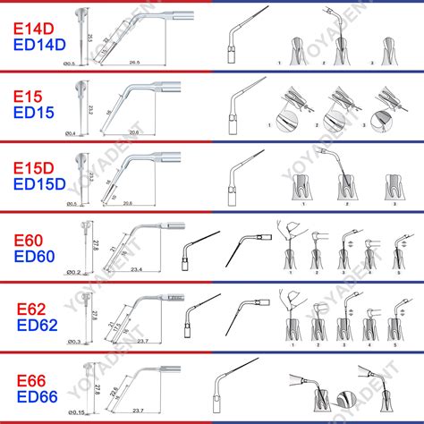 Generic Woodpecker Dte Endo Tips Ultrasonic Scaler Tips Scaling Tips Ed Series Fit Nsk Satelec