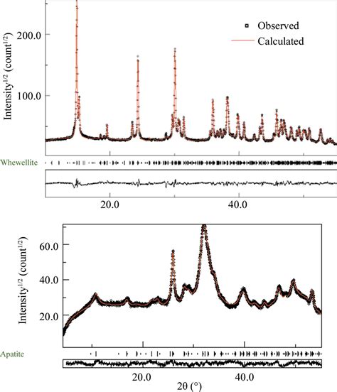 Iucr Qu­antitative Phase Analysis And Microstructural Characterization Of Urinary Tract