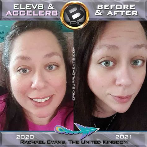 Elev8 Acceler8 For Health Bepic Website Sign Up And Buy Products