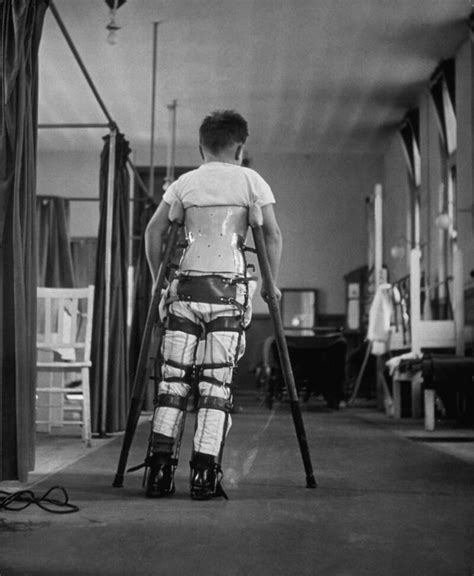 Inside Americas Polio Epidemics In 44 Unsettling Photos
