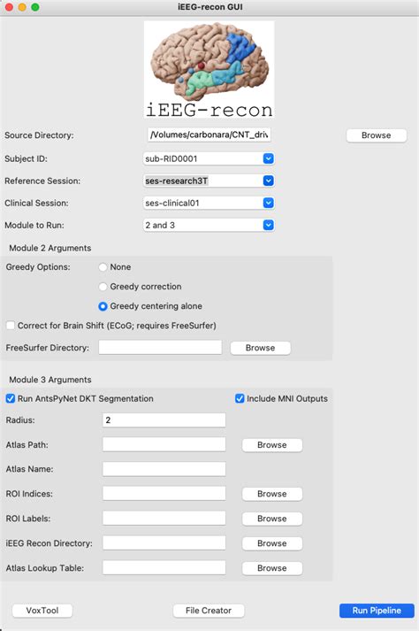 Running The App — Ieeg Recon 01 Documentation
