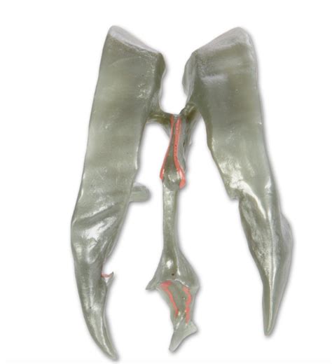 Ventricles Diagram Quizlet