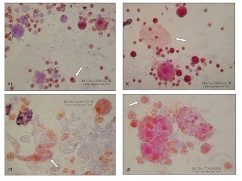 SEDIMENTO URINARIO MANUAL Mind Map