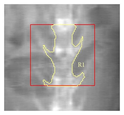 DXA and μCT measurement of vertebrae and femoral condyles a DXA Download Scientific Diagram