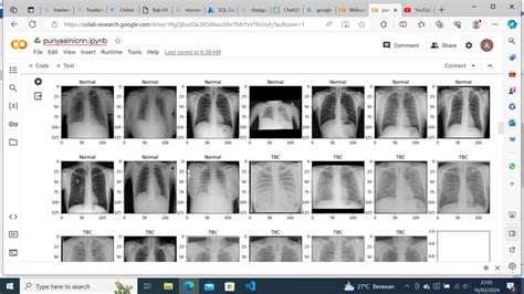Website For Tuberculosis Detection Using Cnn Model Freelancer