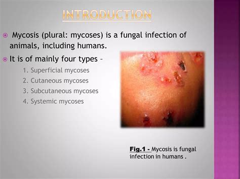 Systemic Mycoses Pptx
