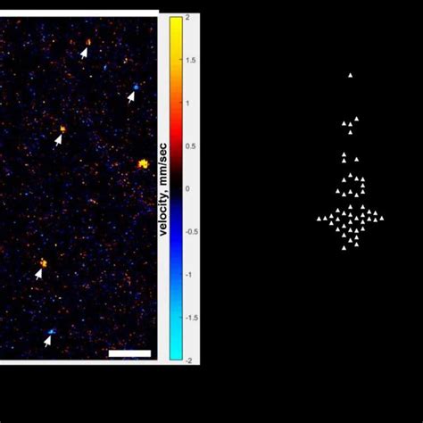 Capillary Flow Velocity Was Increased 24 Hours After Reperfusion