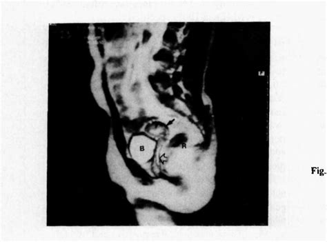 Figure 1 From Imaging In Intersex Disorders Semantic Scholar