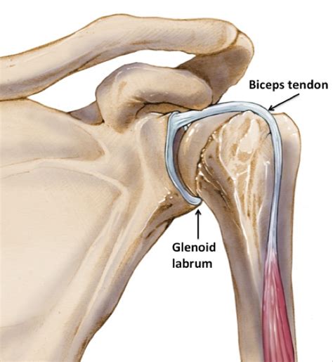 Bankart E Hill Sachs Labral Tears Of The Shoulder And Shoulder