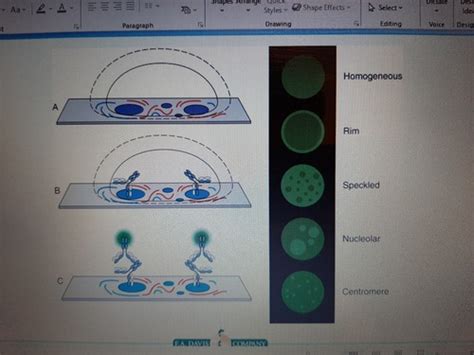 Chapter 21 Spirochete Diseases Chapter 15 Autoimmunity Csf Flow