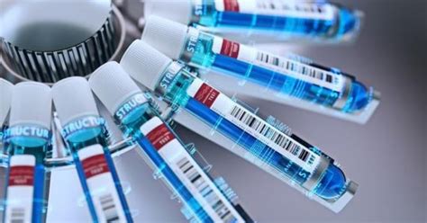 Dr Giger Developed Technology Quantx Acquired By Paragon Biosciences