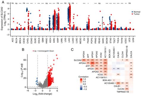 Prediction And Verification Of The Prognostic Biomarker Slc2a2 And Its