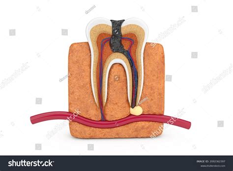 Inside Decay Tooth On White Background Stock Illustration 2092362397