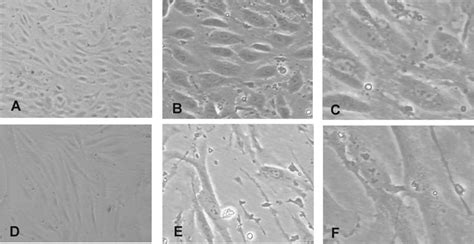 Phase Contrast Micrograph Of Cd31 Immunomagnetic Bead Separated