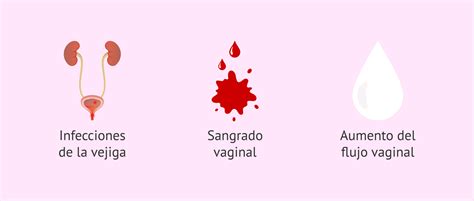 ¿qué Es El Prolapso Uterino Causas Síntomas Y Tratamiento