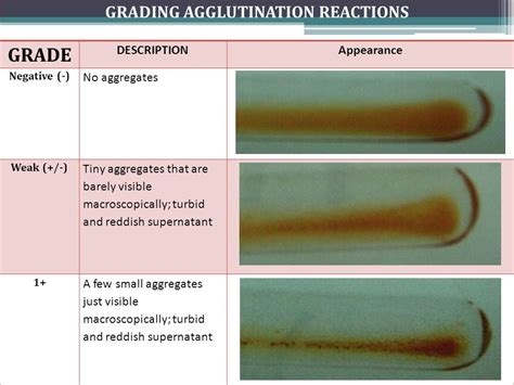 Serology And Immunology Ppt Video Online Download