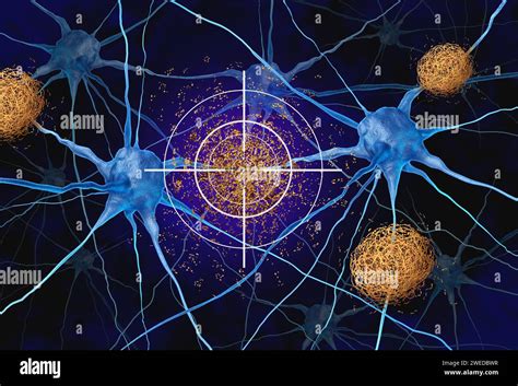 Targeting Amyloid Plaque As A Trgeted Therapy For Plaques Made Of Abnormal Clusters Of Protein