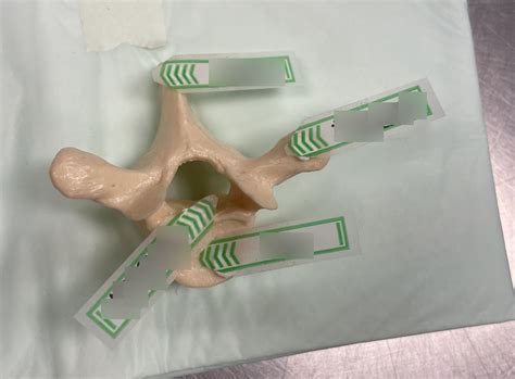 Vertebra Diagram Quizlet