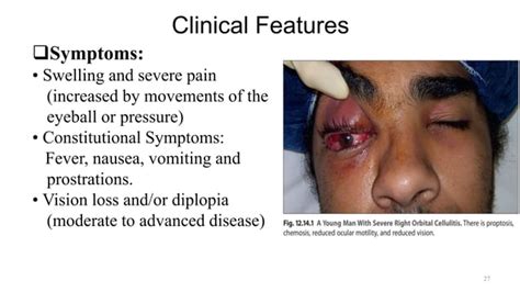 Preseptal Cellulitis And Orbital Cellulitis Dr Prabhat Devkota Pptx Ear Nose And Throat
