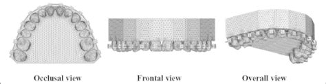 3d Finite Element Model Of Maxillary Dentition Including Pdl Alveolar Download Scientific