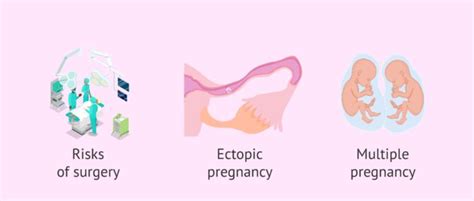 Zygote Intrafallopian Transfer Zift