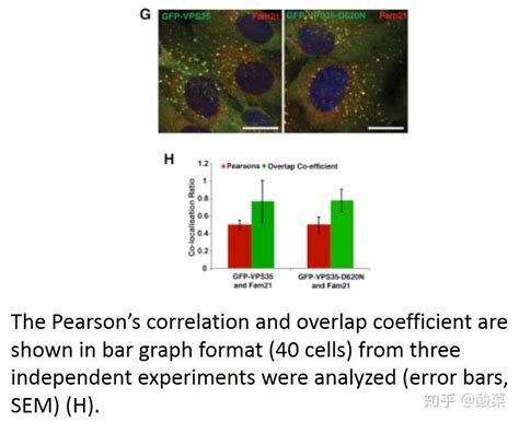 手把手教会荧光共定位分析 知乎