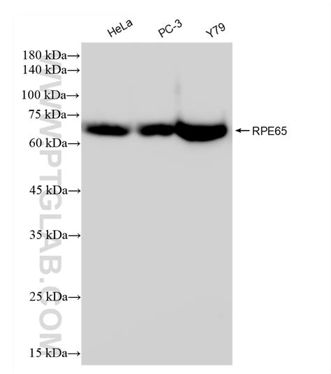 Rpe65 Antibody 83861 1 Rr Proteintech