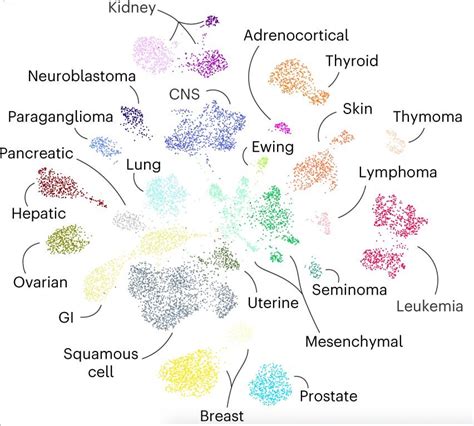 Machine Learning Aided Multiscale Transcriptomics Results In Pediatric