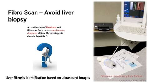 Artificial Intelligence In Biomedical Engineering And Informatics