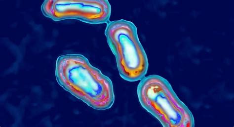 Caso Incomum De Peste Bubônica Foi Identificado Nos Eua Cnn Brasil