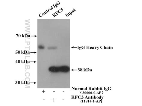 Rfc3 Antibody 11814 1 Ap Proteintech