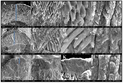 Although No Major Differences In Enamel And Dentin Seem To Exist In The Download Scientific