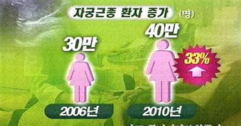 연휴 맞아 자궁근종 수술 환자 급증