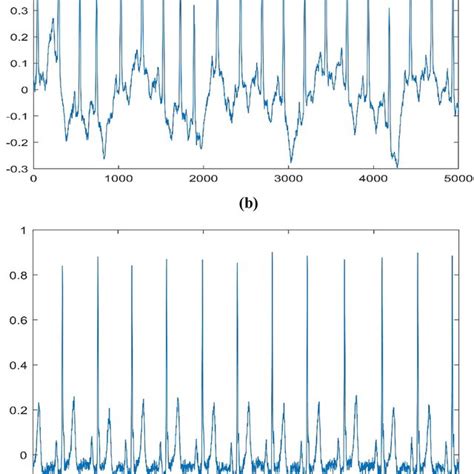 the high‐frequency components of removed high‐frequency interference