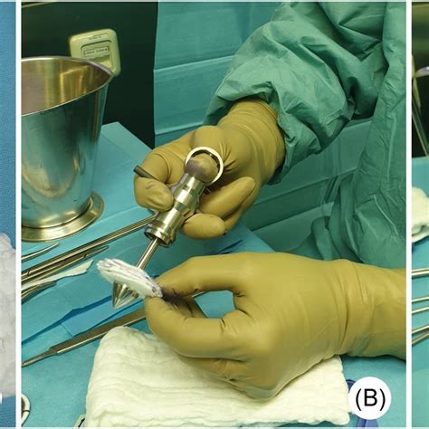 Teflon And Pericardial Patch Marked In The Dimension Of A Ventricular