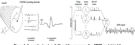 Figure 1 From Computer Assisted Decomposition Of The Electromyograms