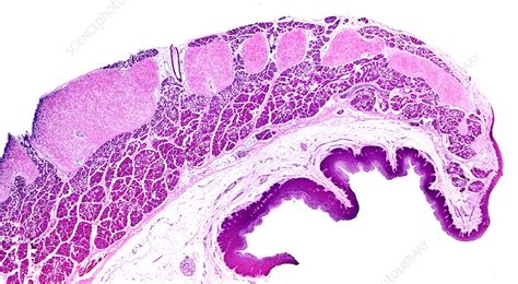 Human Epiglottis Light Micrograph Stock Image C0488549 Science