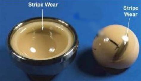 A Ceramic Head And Acetabular Liner From A Patient With Squeaking Hip