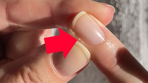 How To Remove A Hangnail Like A Pro Pro Nail Technician Explains