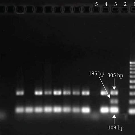 A Pcr Product Electrophoresis Of Enterococcus Isolates Lane 1 Download Scientific Diagram