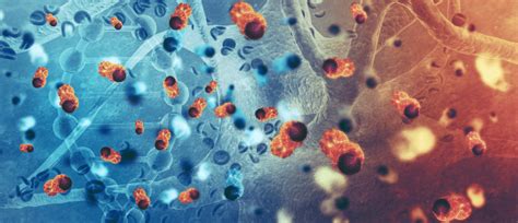 Decipher Testing Utilized For Treatment Of Early Stage Prostate Cancer Oncology Central