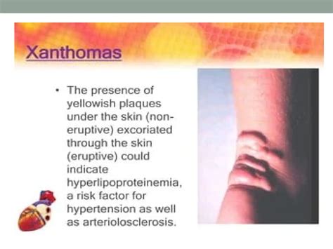 Cardiovascular Assessment For Nursespptx